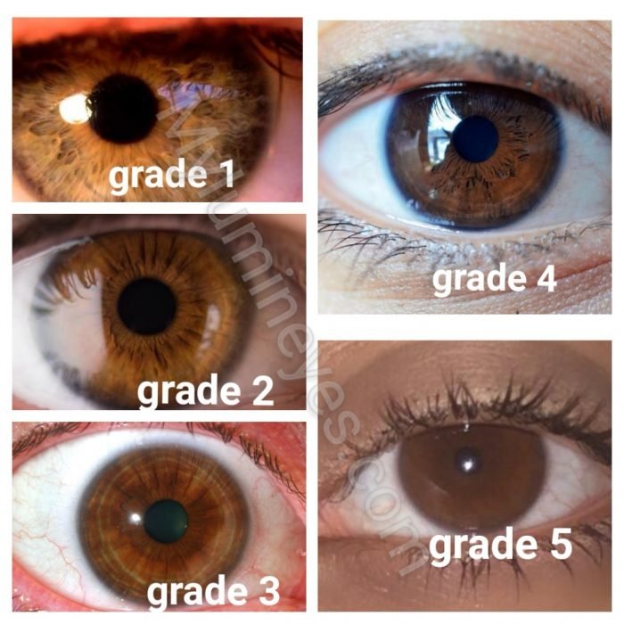 What Color Is My Eye?